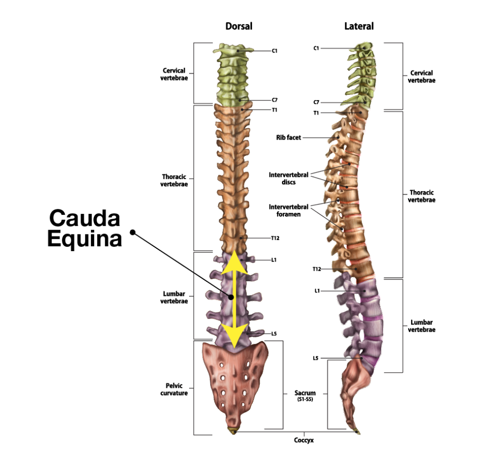 cauda-equina-SpineMD.net